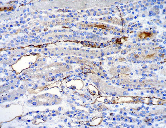 Acute_allograft_dysfunction
