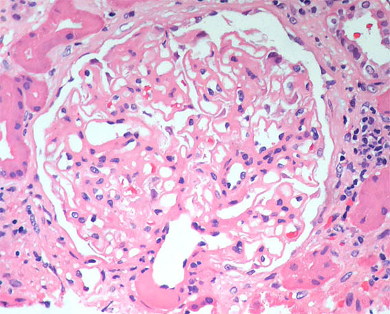 Microspherular structures