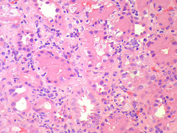 Microspherular structures